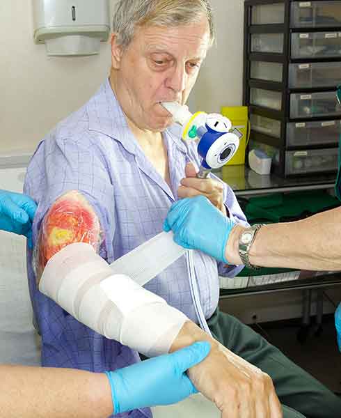 Cuidados al paciente quemado - Fuden